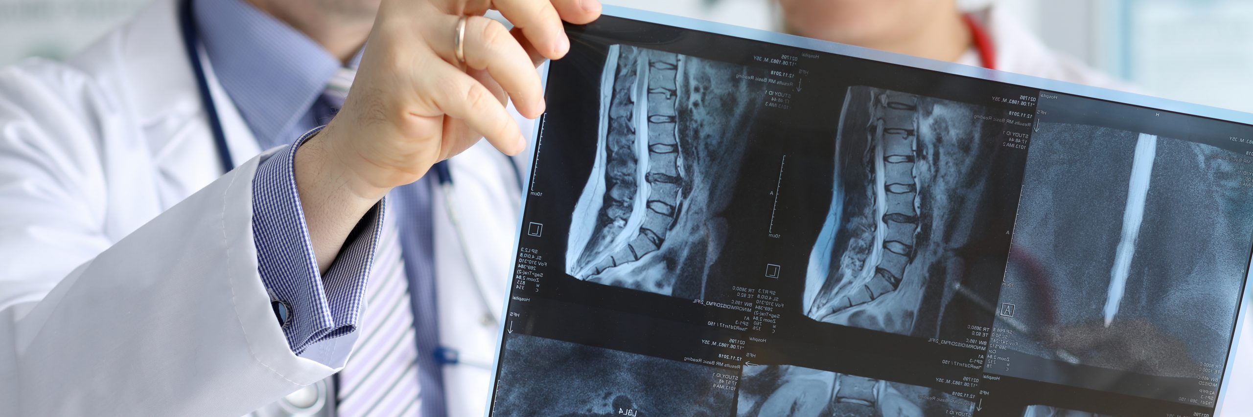 Important Facts About X-Rays - Hollywood Diagnostics